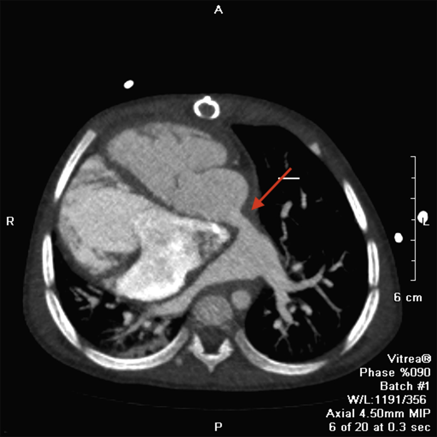 TGA: Multimodality Imaging – ASE