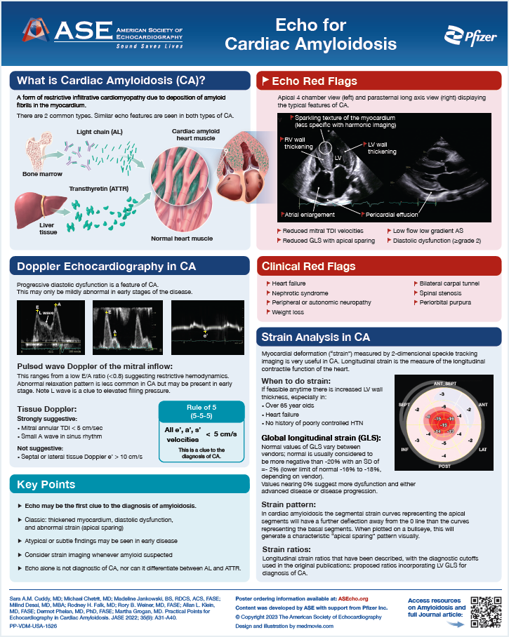 Echo for Cardiac Amyloidosis Poster – ASE