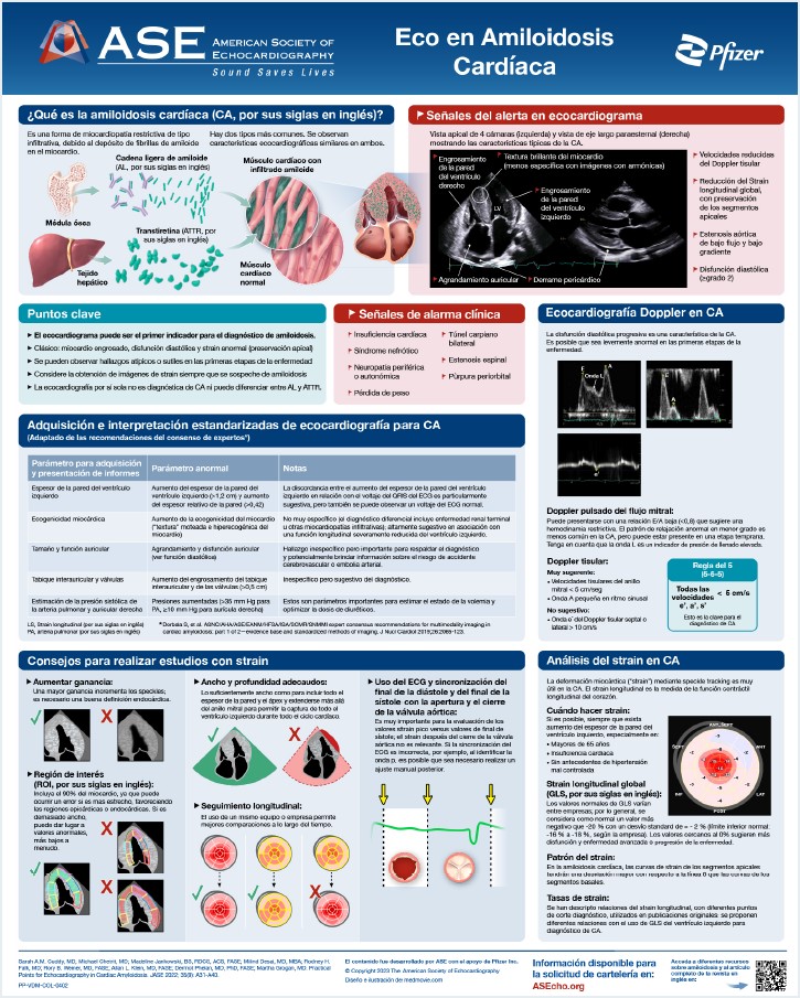 Echo for Cardiac Amyloidosis Poster (Spanish-Translated) – ASE