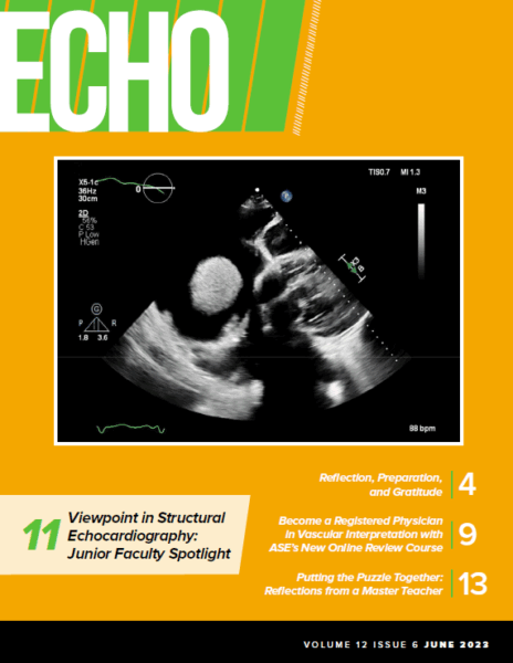 Echo Magazine June 2023 – ASE