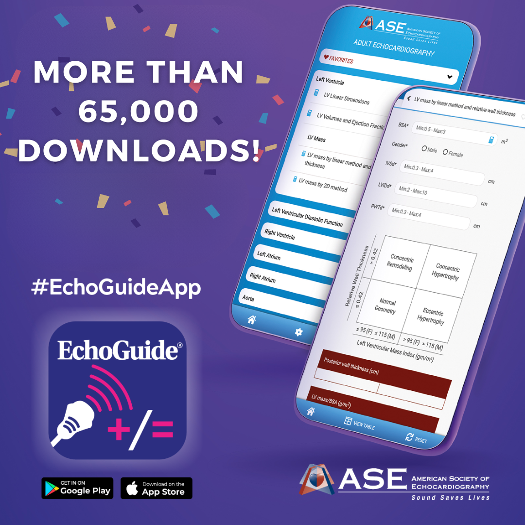EchoGuide Surpasses 65,000 Downloads - ASE