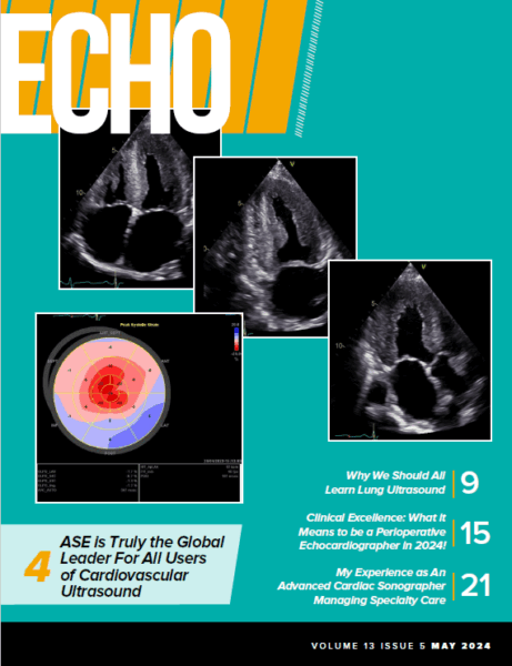 Echo Magazine May 2024 – ASE