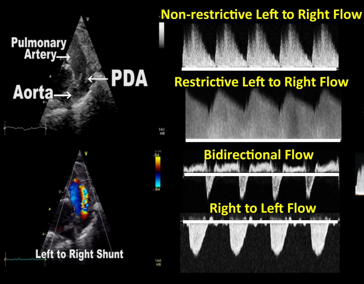 ASE Guidelines - ASE