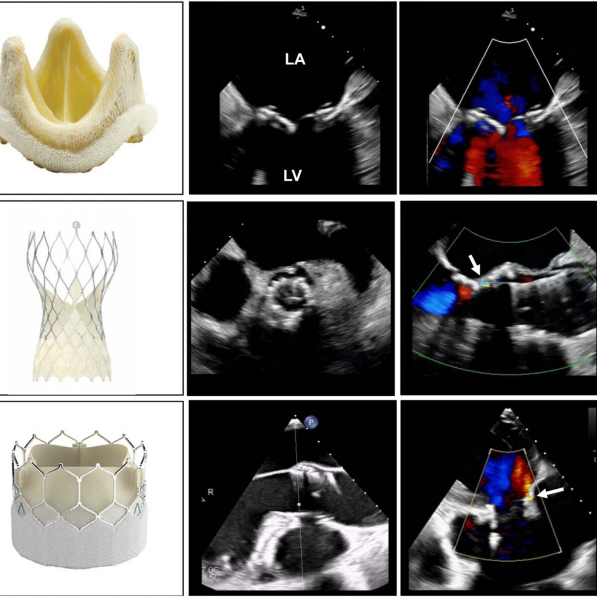 ASE Guidelines - ASE
