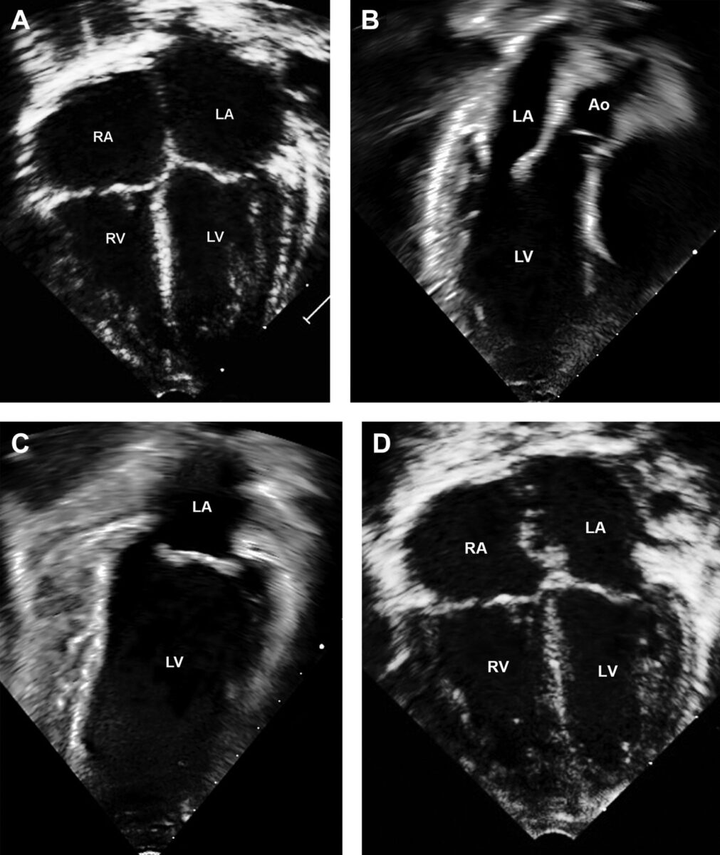 ASE Guidelines - ASE