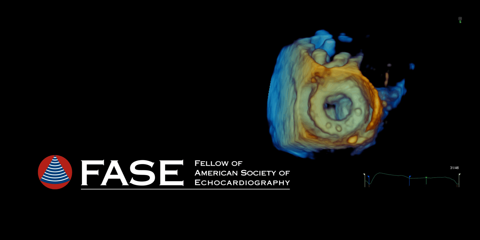 Fellow of ASE (FASE) - ASE