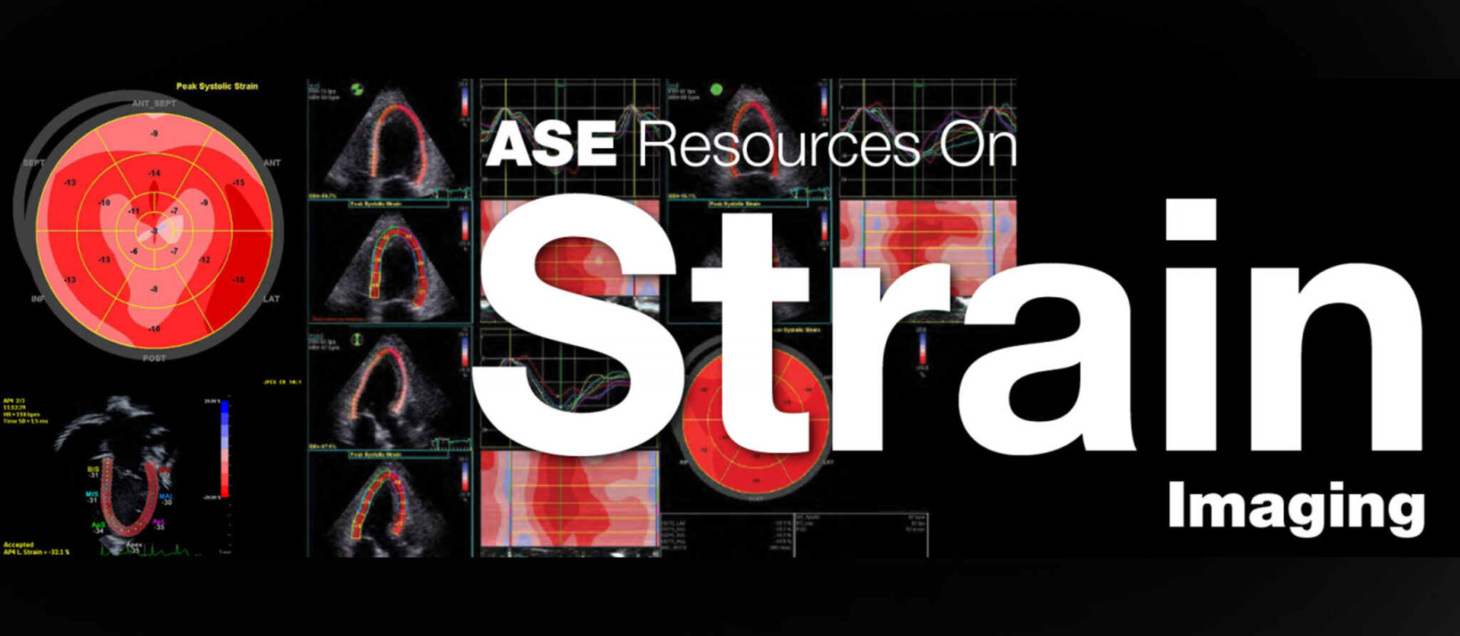 Strain Imaging - ASE