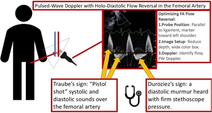 An Instant Hit: July CASE - ASE